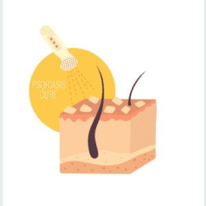 Understanding Stress Rash: Causes, Symptoms, and Treatment