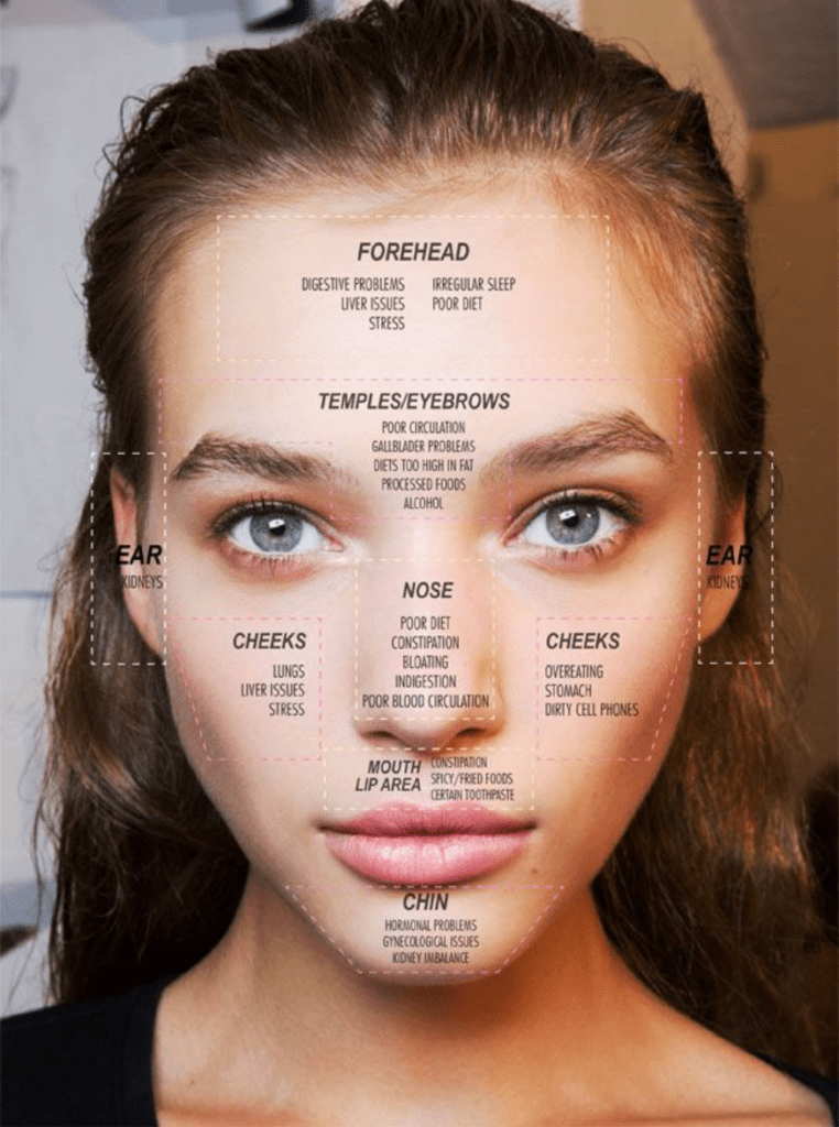 Understanding Cheek Acne: Causes and Effective Treatments