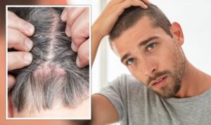 Psoriasis vs Fungal Infection: Key Differences Explained