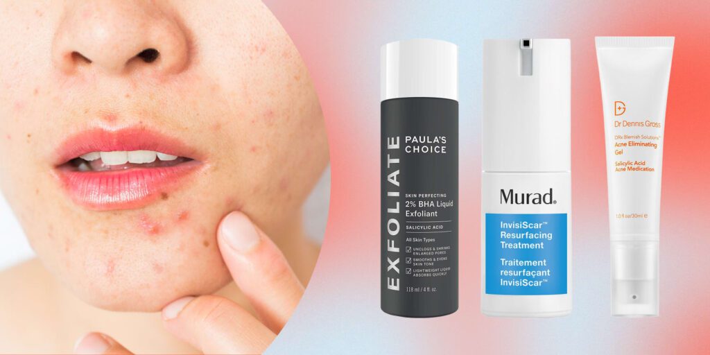 Treating Cystic Acne: What To Do and What Not To Do